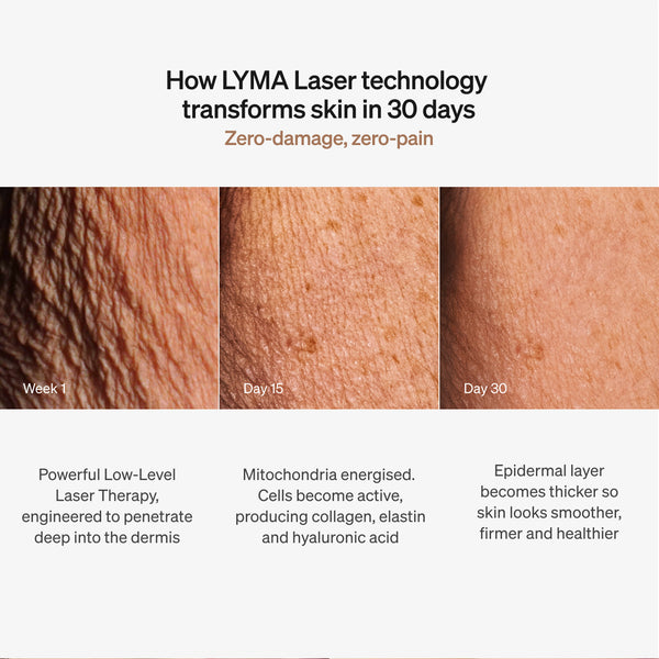 Lyma Laser Starter Kit – Apotheca Beauty